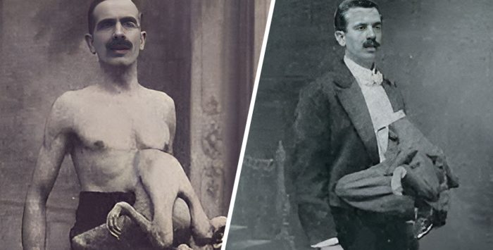 Who is Jean Libbera? Professional Life, X-Ray Photo